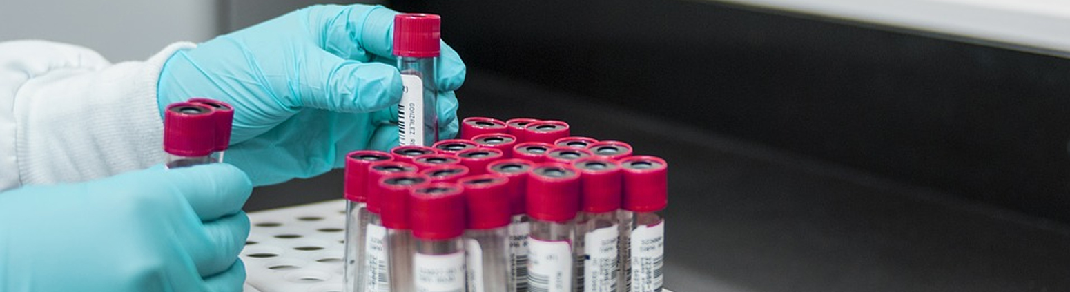 Animal Biochemical Analyzer | Au