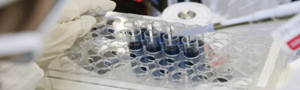 Comparison of Spectrophotometer, Semi-automatic And Fully Automatic ...