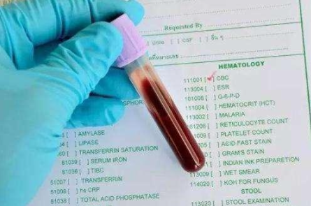 The Difference Between Blood Biochemistry and Routine Blood Tests