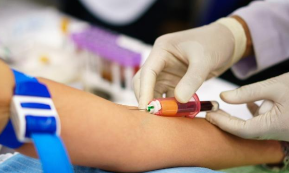 The 9 Main Types And Technical Principles of IVD Reagent