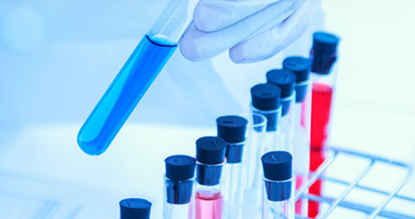 In Vitro Diagnostic Reagents (IVD) Product Definition and Classification